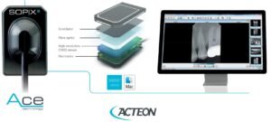 Sopix2 Digital X-Ray Sensors - Universadent