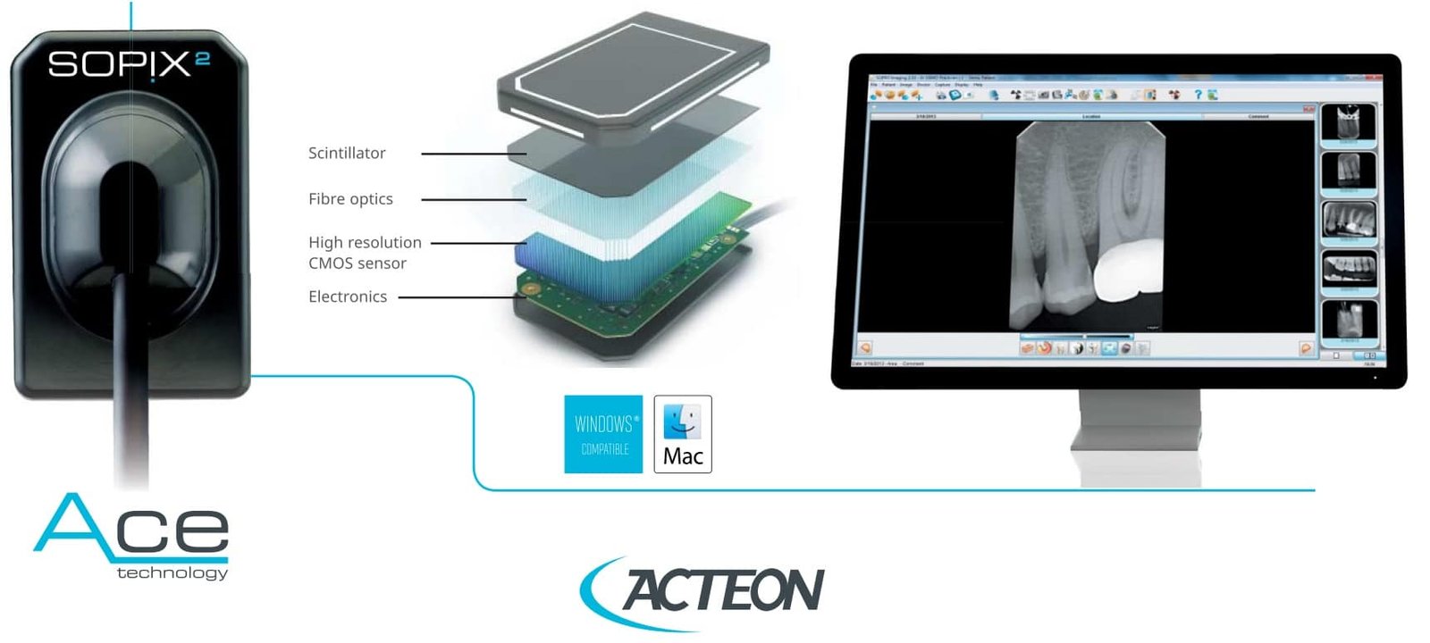 Sopix2 Digital X-Ray Sensors - Universadent