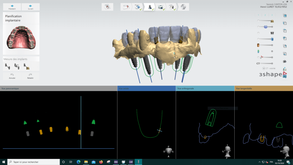 3Shape TRIOS 4 Wireless Pod INTRAORAL SCANNER | Universadent Inc