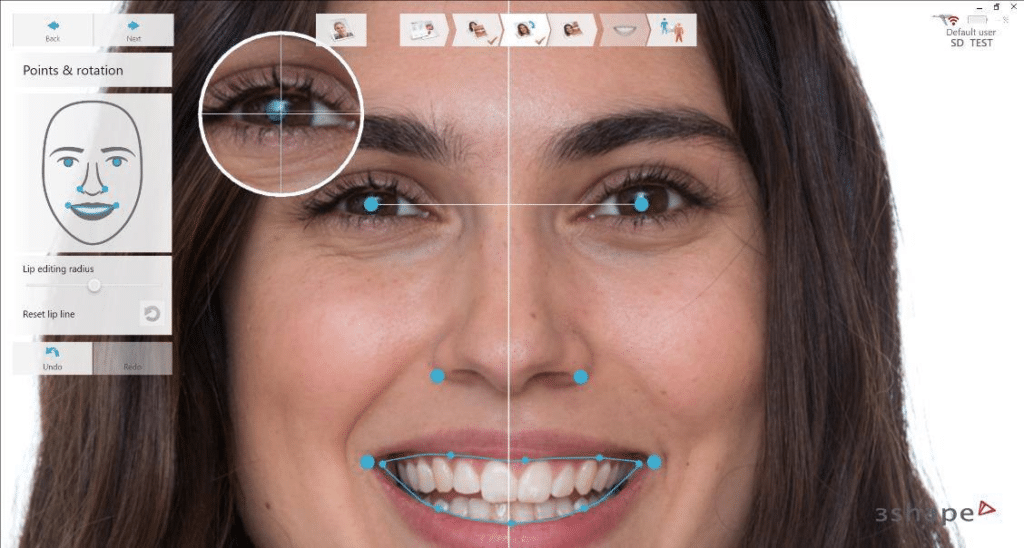 3Shape TRIOS 4 Wireless Pod INTRAORAL SCANNER | Universadent Inc