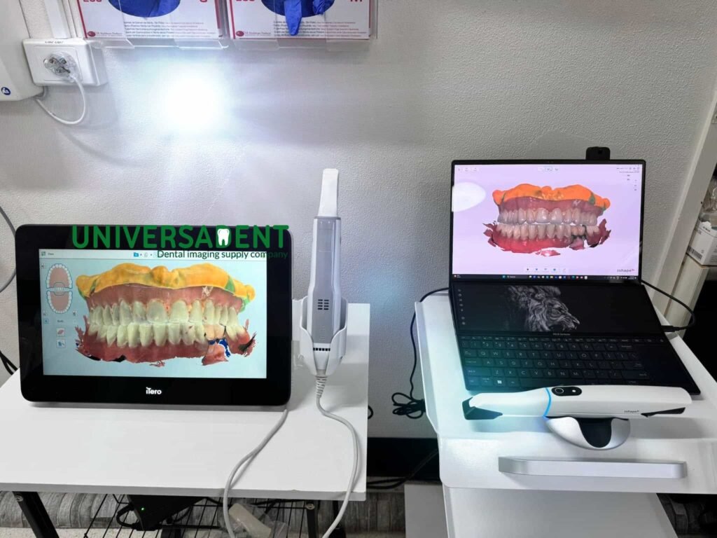 iTero Lumina Intraoral Scanner - Universadent Inc